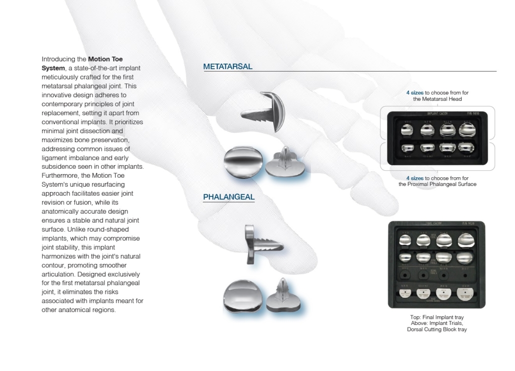 The Motion Toe System – iNTREPID ORTHOPEDICS